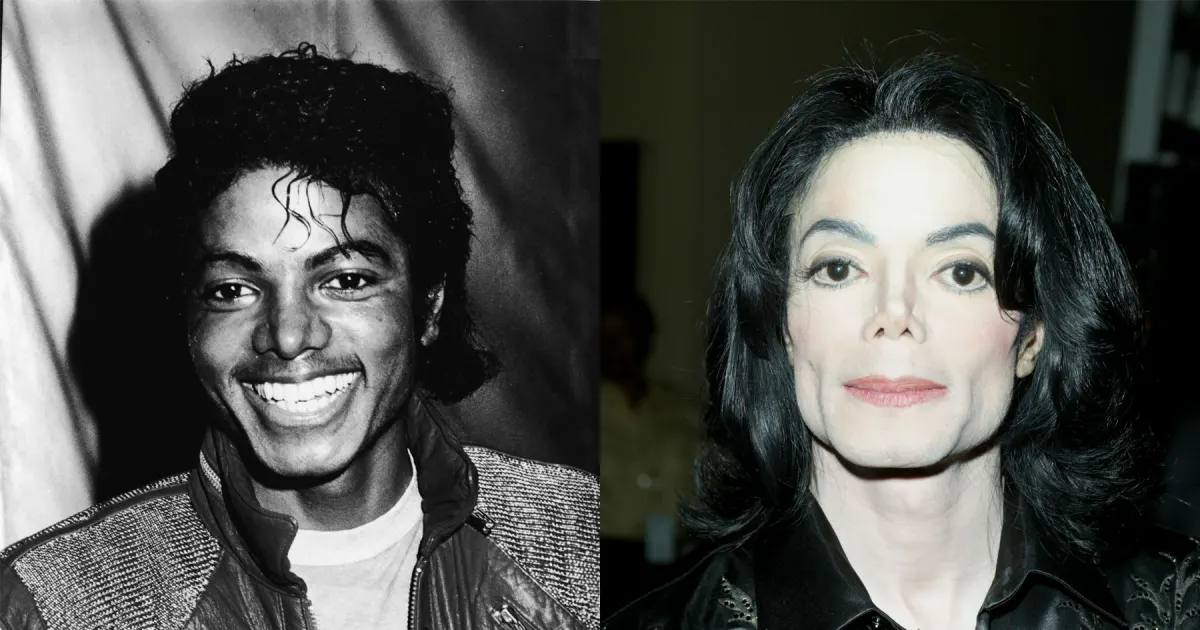 Michael Jacksons Beauty-OPs: So hat er über die Jahre verändert
