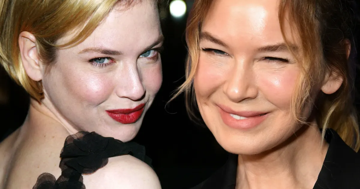 „Bridget Jones“-Renée Zellwegers heftige Verwandlung