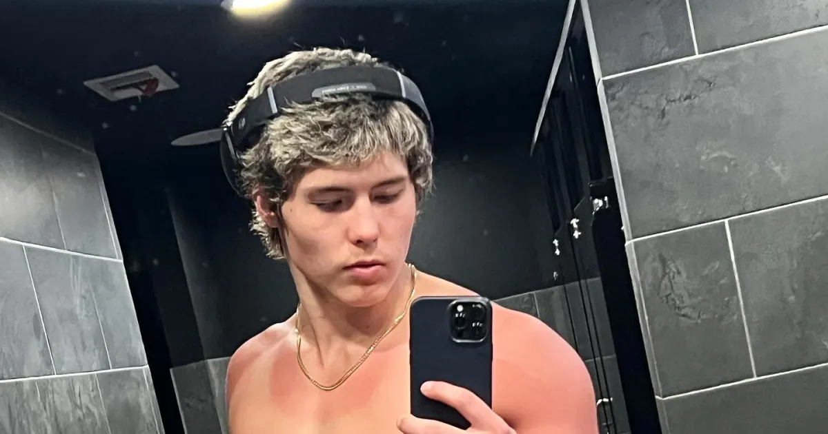 Dramatischer Unfall: TikTok-Star liegt auf Intensivstation