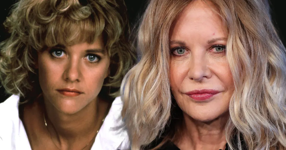 Hollywood-Stars, die sich durch Botox krass veränderten